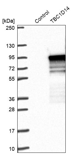 Rabbit Polyclonal Anti-TBC1D14 Antibody - Buy for research - Highly ...