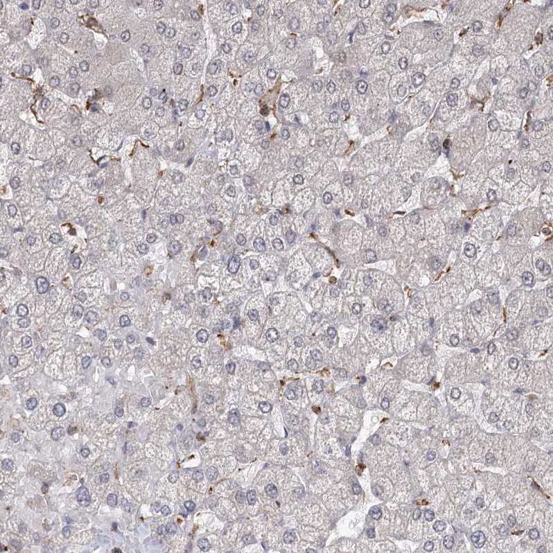 Rabbit Polyclonal Anti-MEPE Antibody - Buy for research - Highly ...
