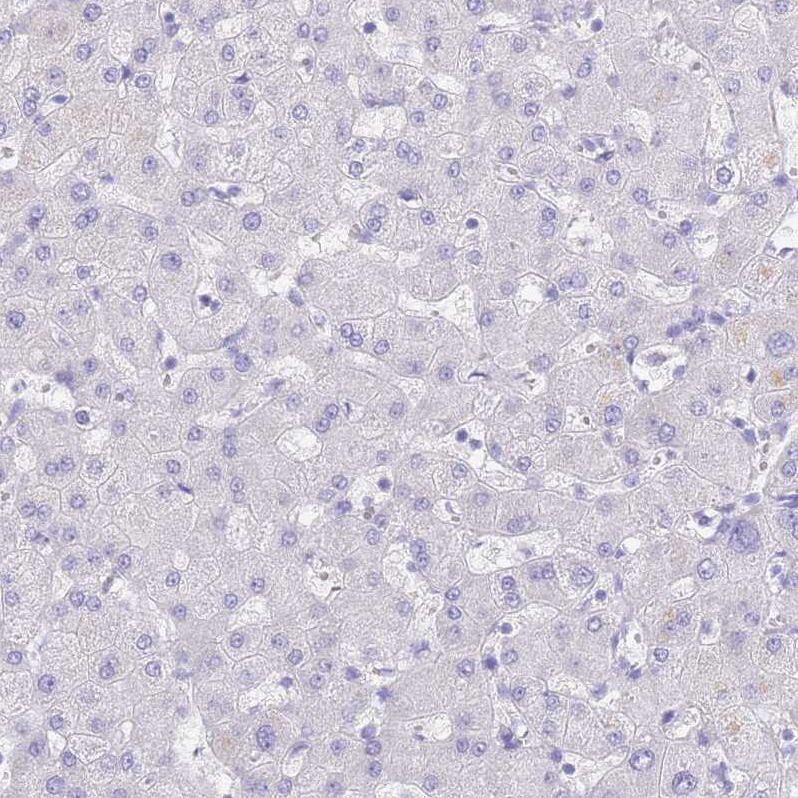 Rabbit Polyclonal Anti-CPB1 Antibody - Buy for research - Highly ...