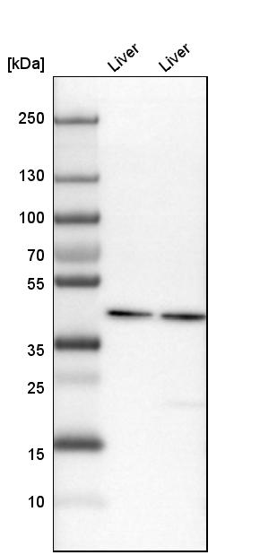 Rabbit Polyclonal Anti-HPD Antibody - Buy for research - Highly specific, rigorously validated ...
