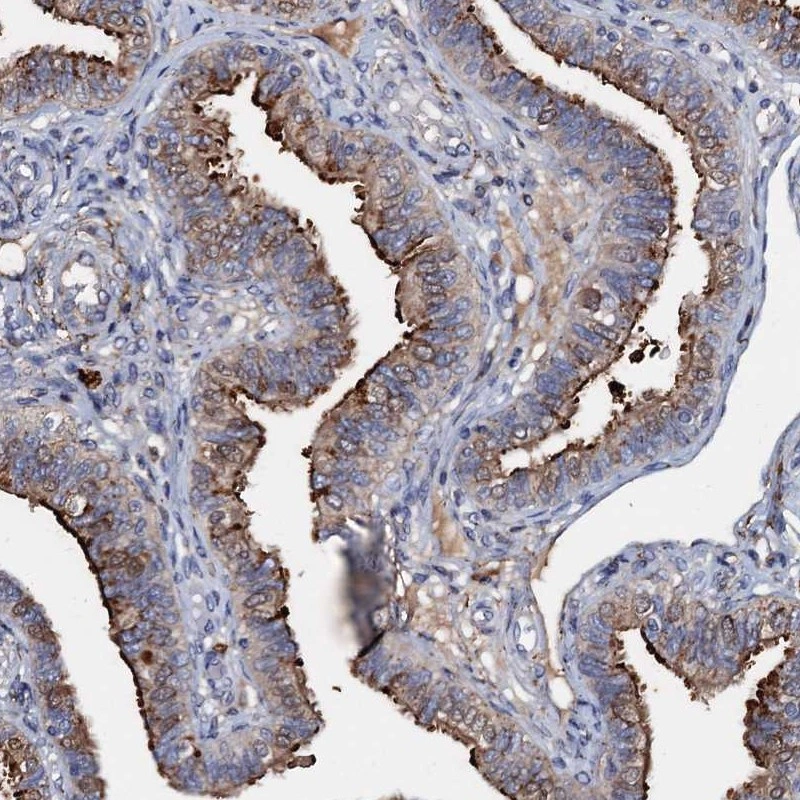 Anti-MANSC4 Human Protein Atlas Antibody