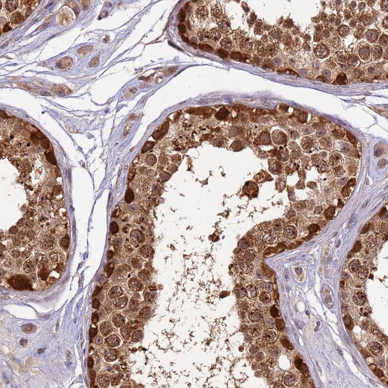 Anti-RAPGEF3 Human Protein Atlas Antibody