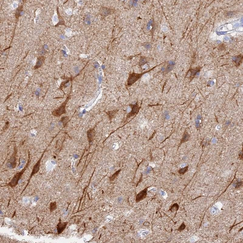 Anti-VPS33B Human Protein Atlas Antibody