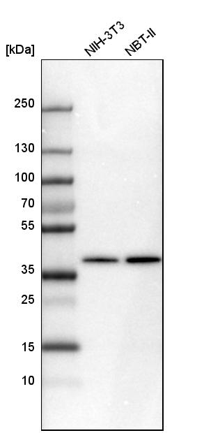 Anti-SORD Human Protein Atlas Antibody