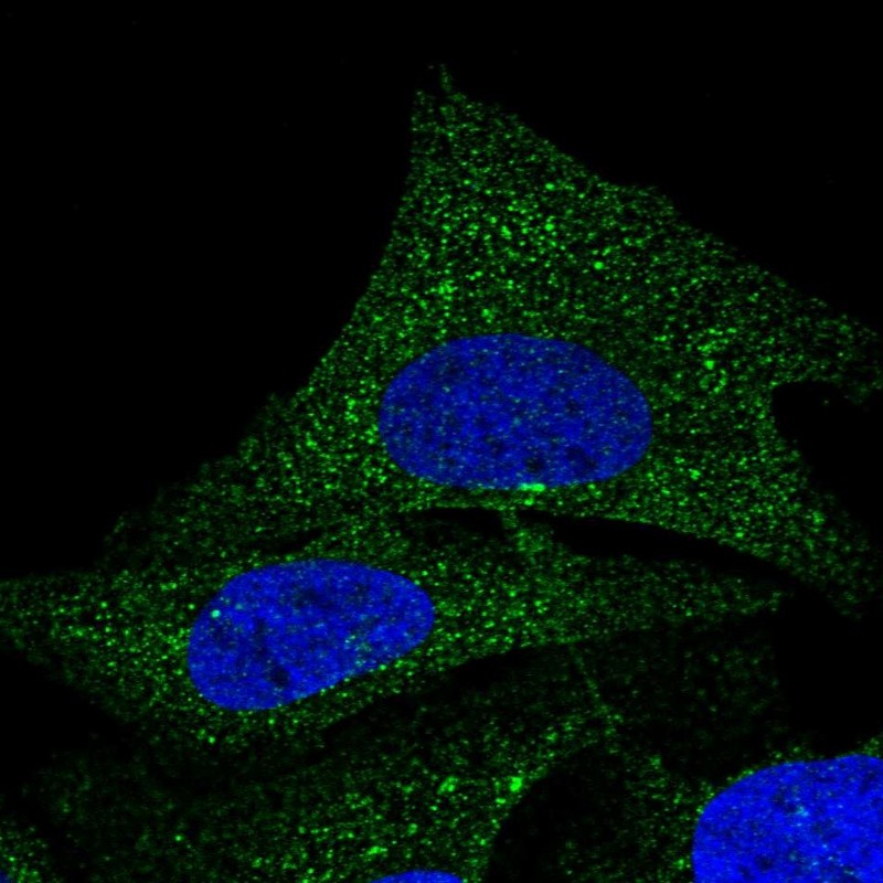 Rabbit Polyclonal Anti-COQ9 Antibody - Buy for research - Highly ...