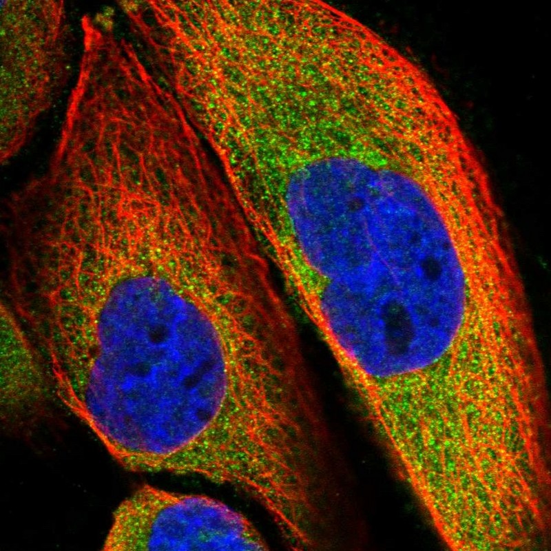 Rabbit Polyclonal Anti-SLC9A5 Antibody - Buy for research - Highly ...