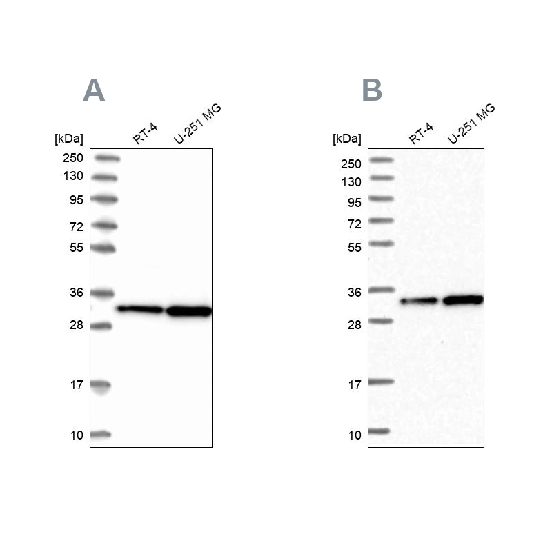 Anti-TBCB Human Protein Atlas Antibody