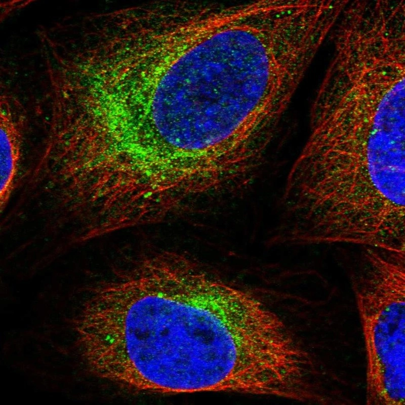 Anti-SCN3B Human Protein Atlas Antibody