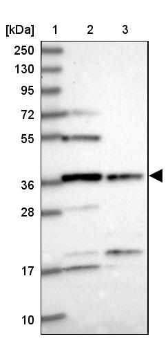 Rabbit Polyclonal Anti-FAM118B Antibody - Buy for research - Highly ...