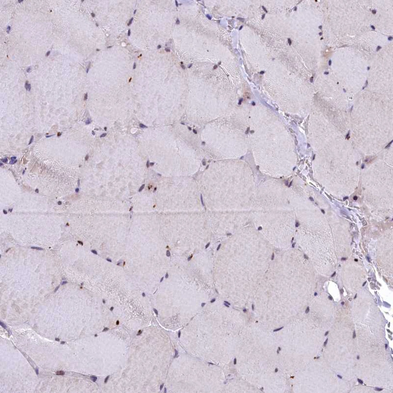 Anti-SLC39A6 Human Protein Atlas Antibody
