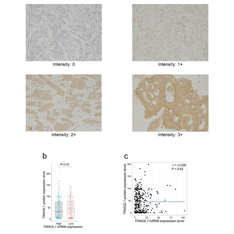 The anti-TINAGL1 polyclonal antibody for breast cancer research