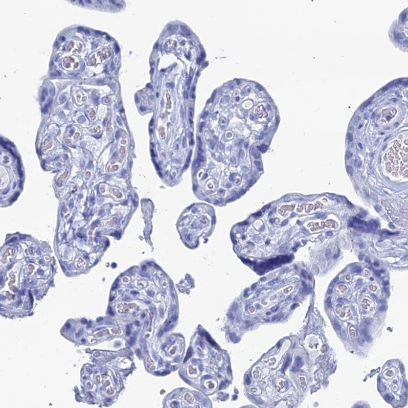 Anti-ENPP3 Human Protein Atlas Antibody