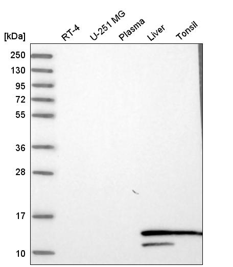 Anti-HBA1 Human Protein Atlas Antibody