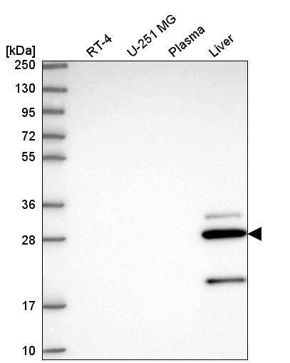 Rabbit Polyclonal Anti-CCS Antibody - Buy for research - Highly specific, rigorously validated ...