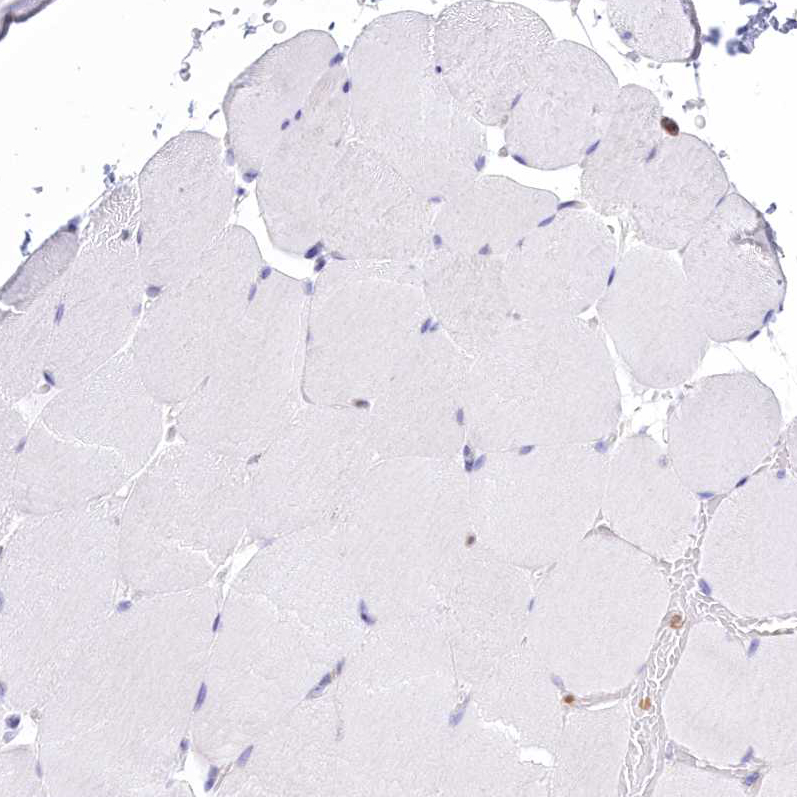 Anti-HM13 Human Protein Atlas Antibody