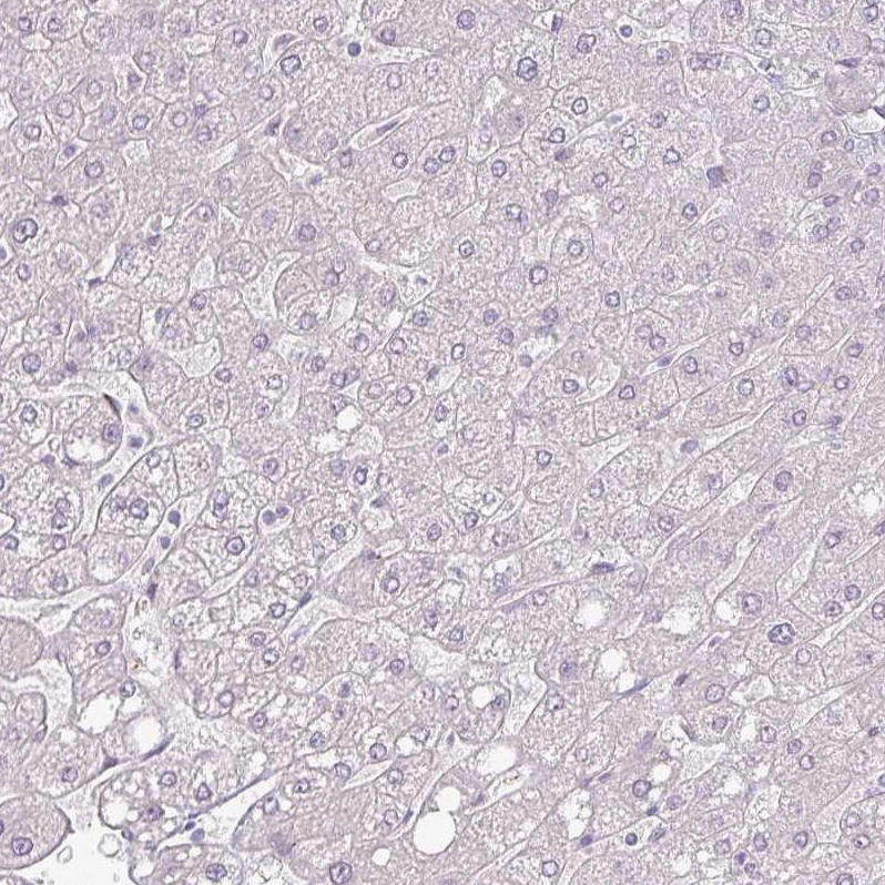 Anti-ATP8B2 Human Protein Atlas Antibody