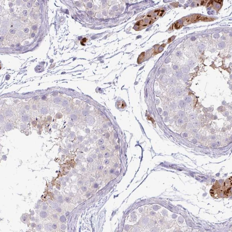 Anti-IRGC Human Protein Atlas Antibody