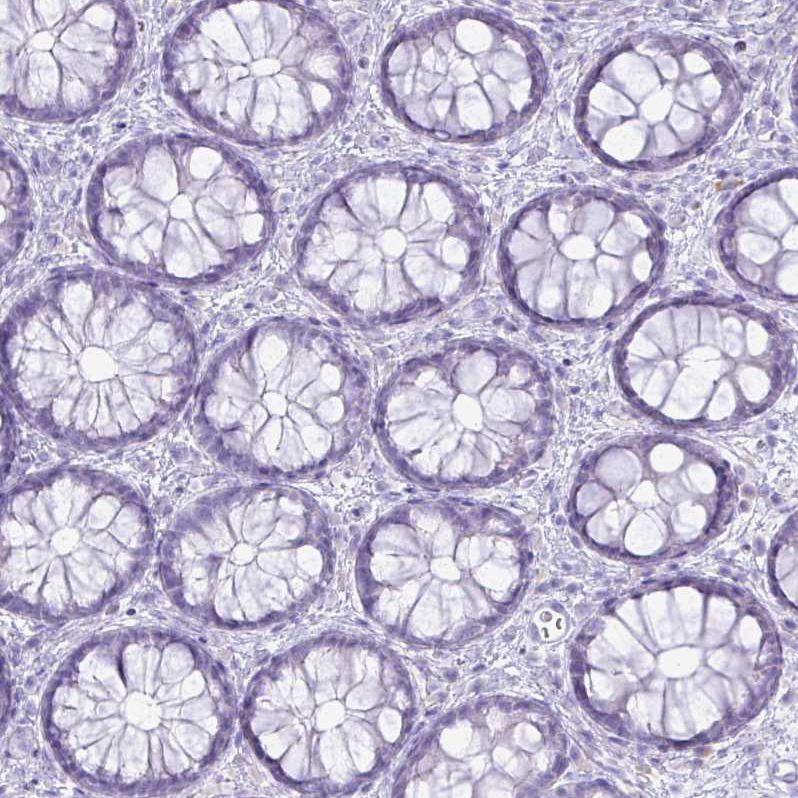 Anti-PGA3 Human Protein Atlas Antibody