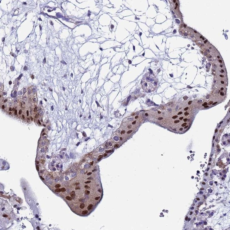 Anti-POP5 Human Protein Atlas Antibody