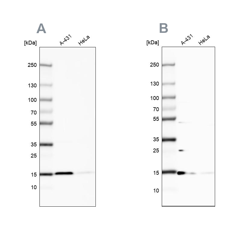 Rabbit Polyclonal Anti-CCDC58 Antibody - Buy for research - Highly specific, rigorously ...