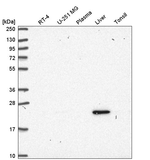 Rabbit Polyclonal Anti-UBB Antibody - Buy for research - Highly specific, rigorously validated ...
