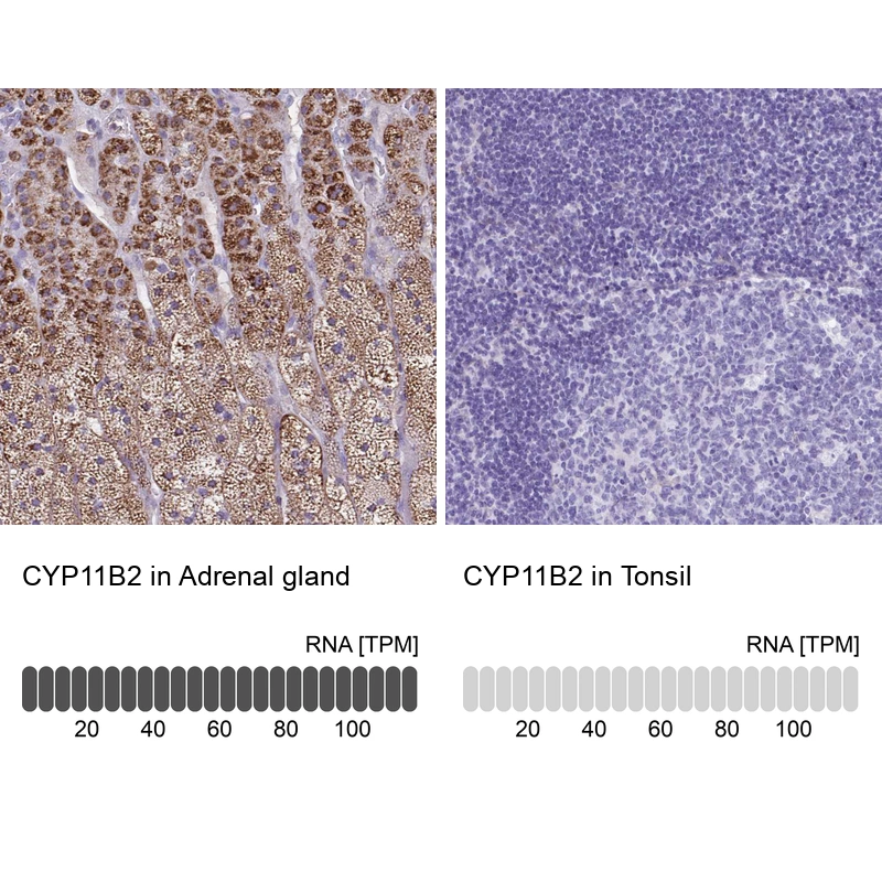 Anti-CYP11B2 Human Protein Atlas Antibody