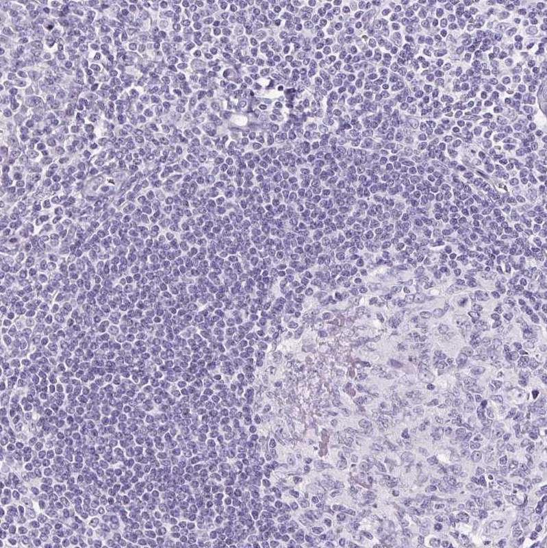 Anti-NPHS2 Human Protein Atlas Antibody