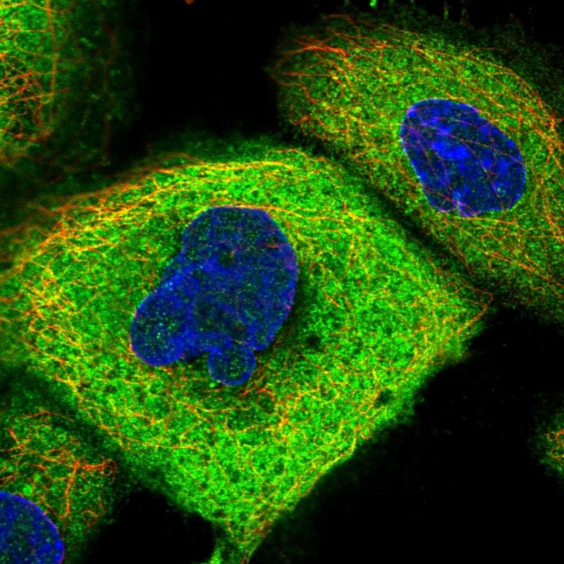 Rabbit Polyclonal Anti-CCDC112 Antibody - Buy for research - Highly ...