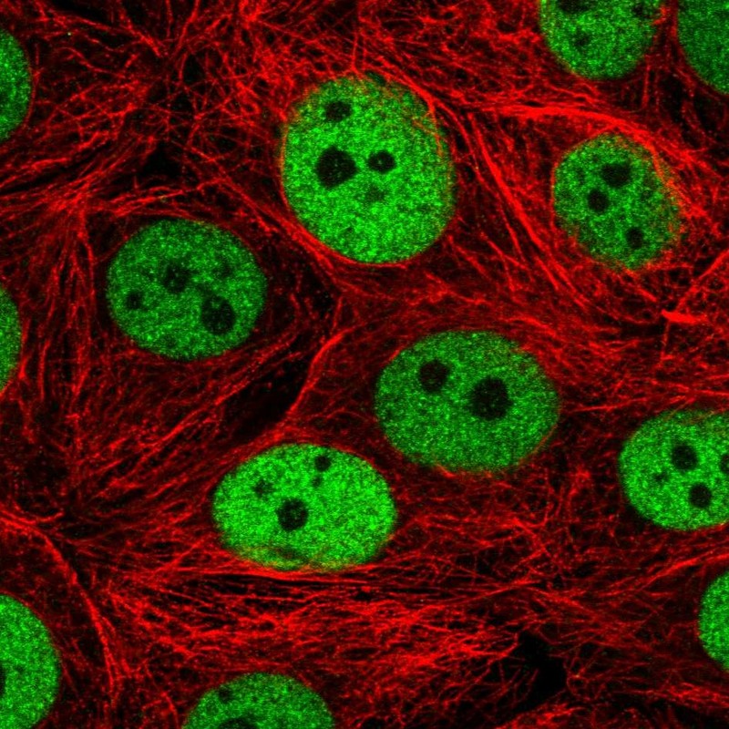 Anti-IRF2BPL Human Protein Atlas Antibody