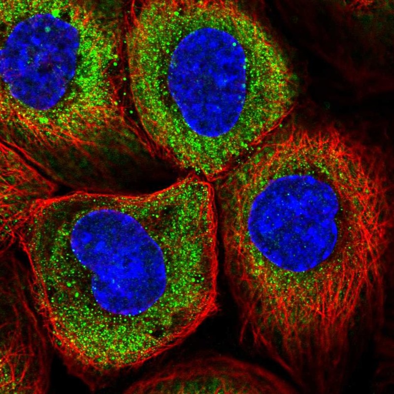 Rabbit Polyclonal Anti-TRIM39 Antibody - Buy for research - Highly specific, rigorously ...