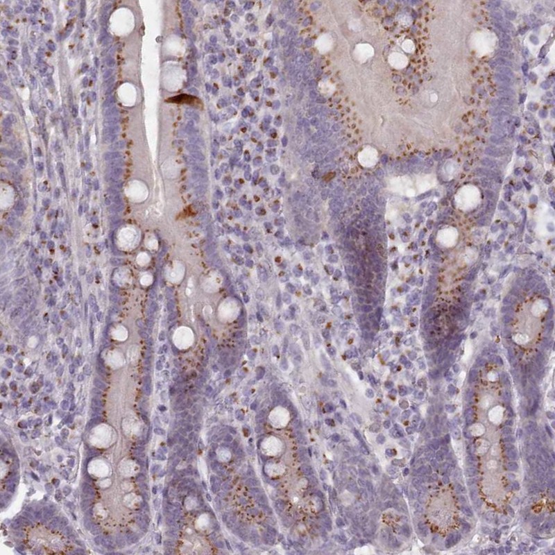 Rabbit Polyclonal Anti Man1b1 Antibody Buy For Research Highly