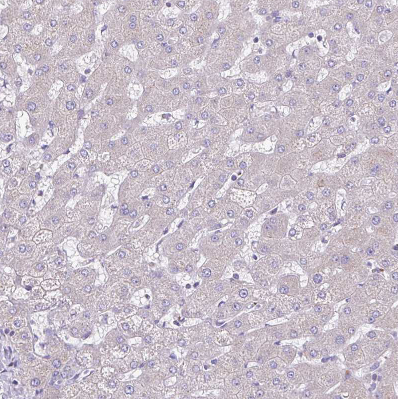 Rabbit Polyclonal Anti-COL17A1 Antibody - Buy for research - Highly ...