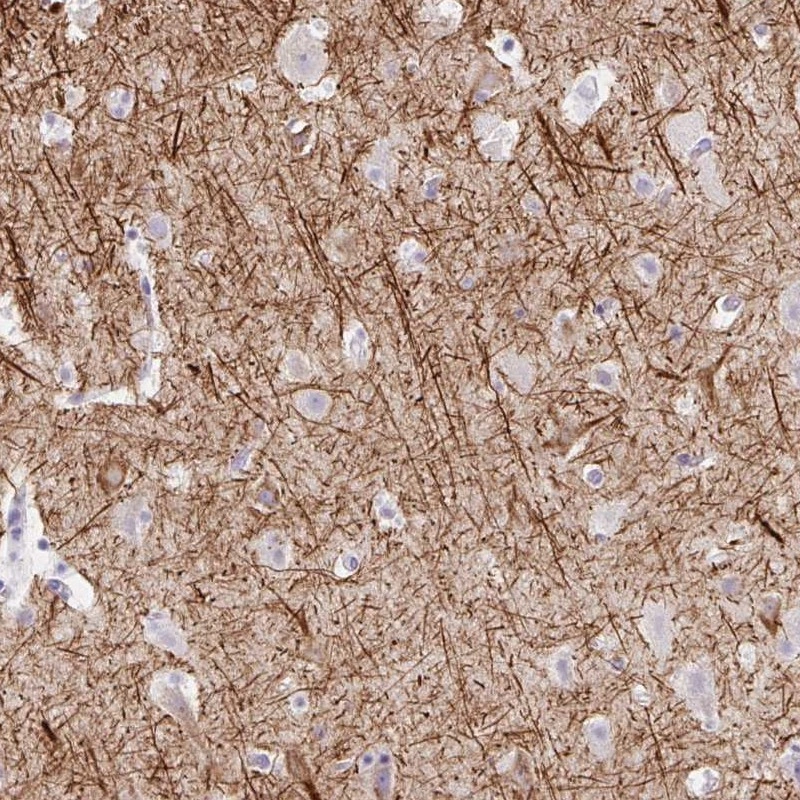 Anti-EMC4 Human Protein Atlas Antibody