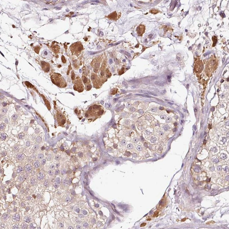 Anti-UTP14C Human Protein Atlas Antibody