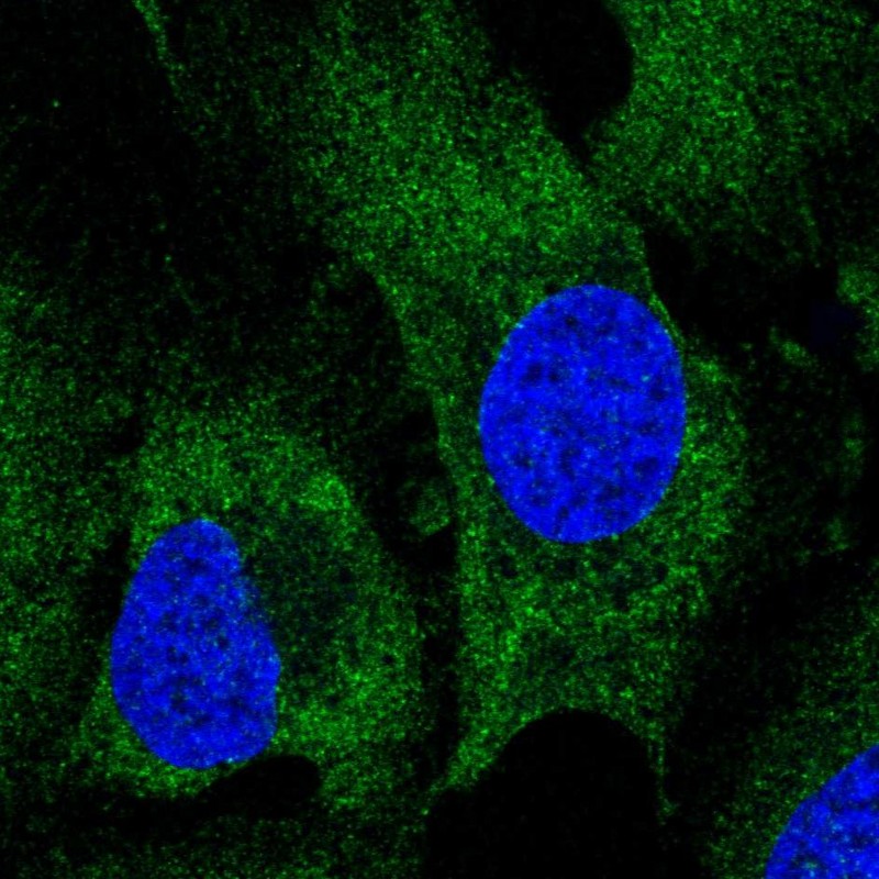 Rabbit Polyclonal Anti-GIGYF2 Antibody - Buy for research - Highly ...