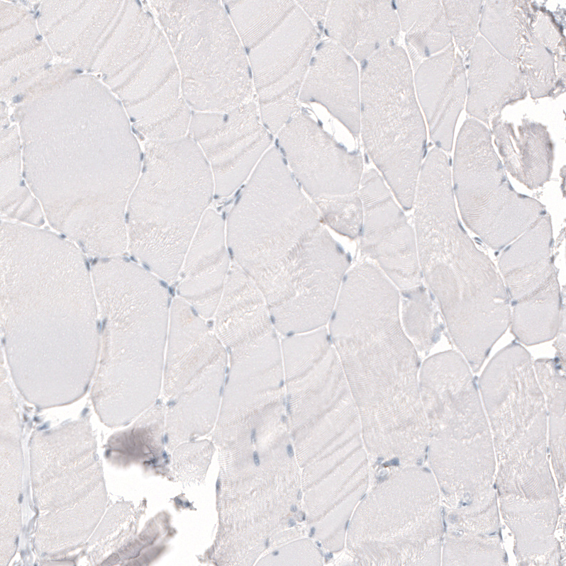 Mouse Monoclonal Anti-NCAM1 Antibody - Buy for research - Highly ...