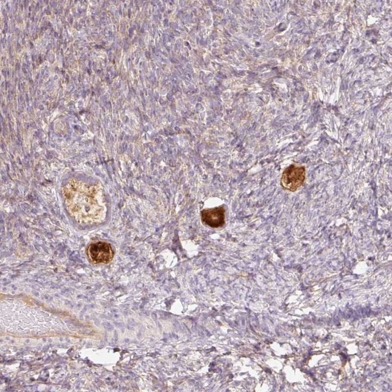 Anti-NLRP5 Human Protein Atlas Antibody