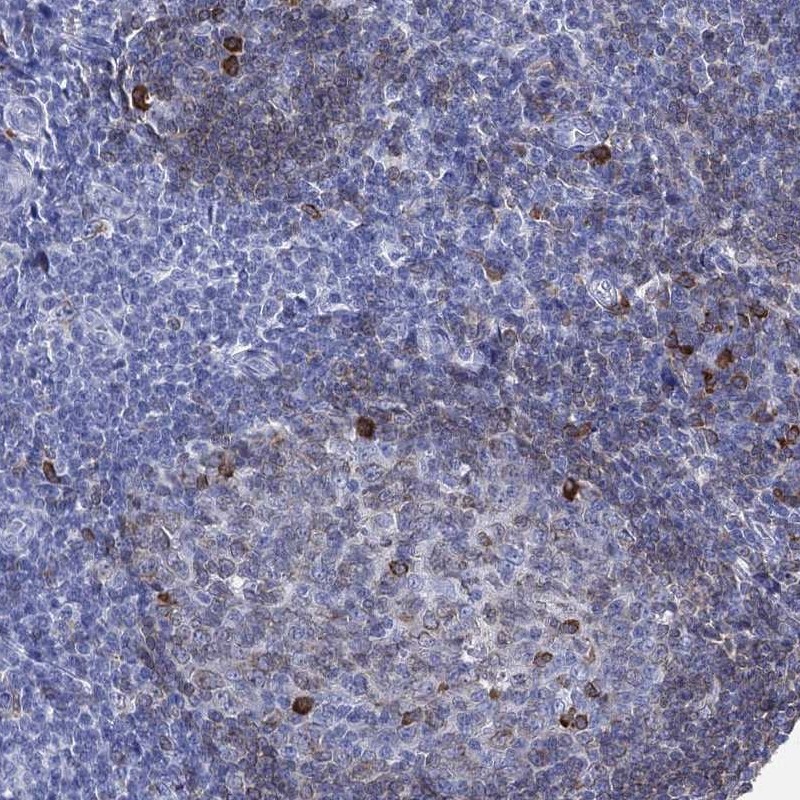 Rabbit Polyclonal Anti-CD79A Antibody - Buy for research - Highly ...