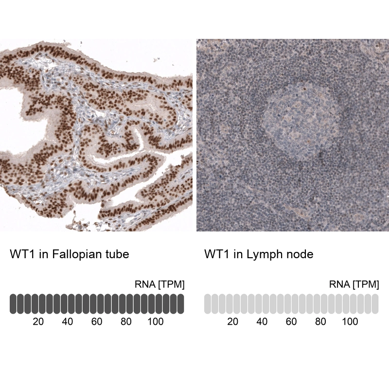 Anti-WT1 Monoclonal Atlas Antibody