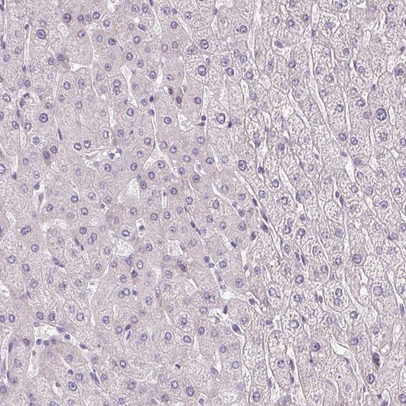 Anti-CYP11B2 Human Protein Atlas Antibody