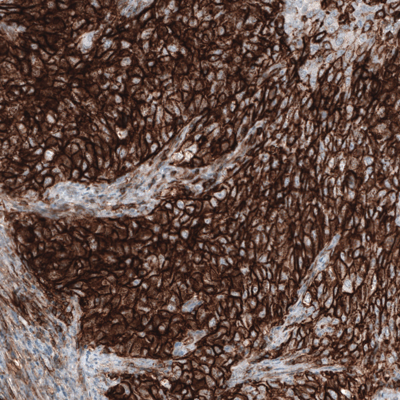 Anti-CD44 Monoclonal Atlas Antibody