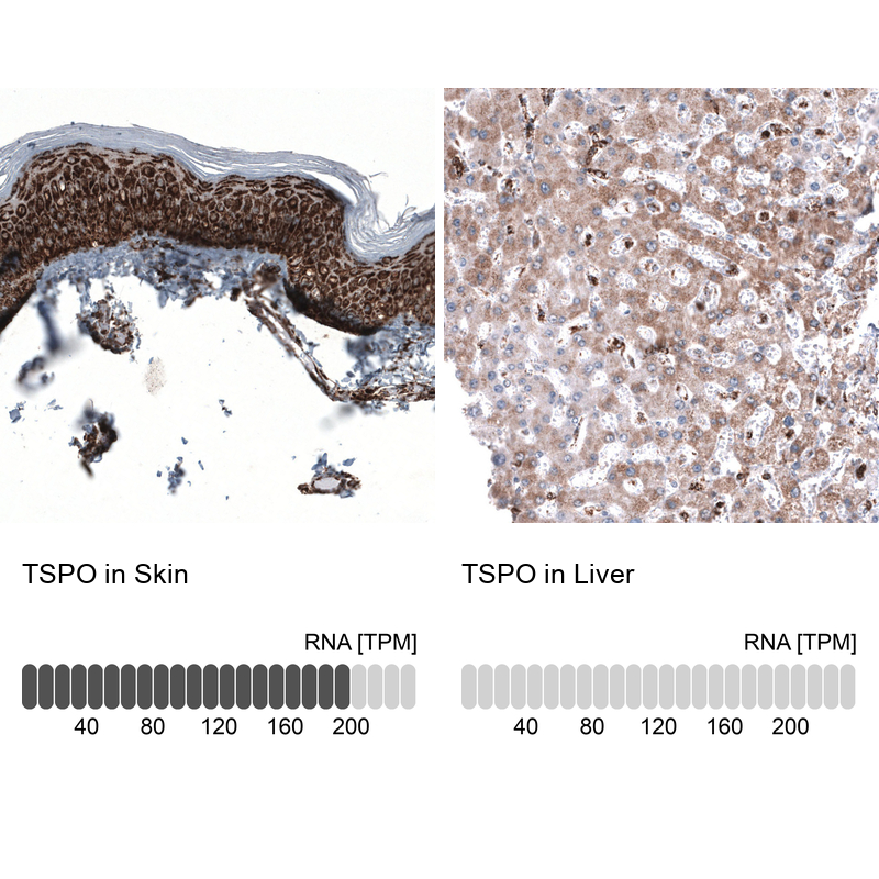 Mouse Monoclonal Anti-TSPO Antibody - Buy for research - Highly ...