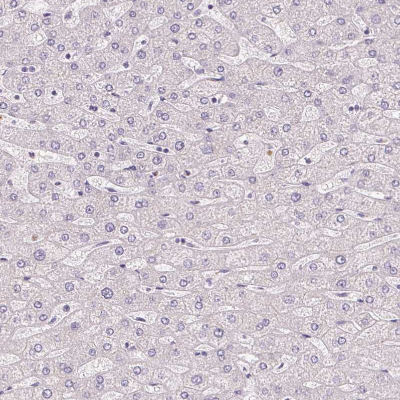 Anti-SMTN Human Protein Atlas Antibody
