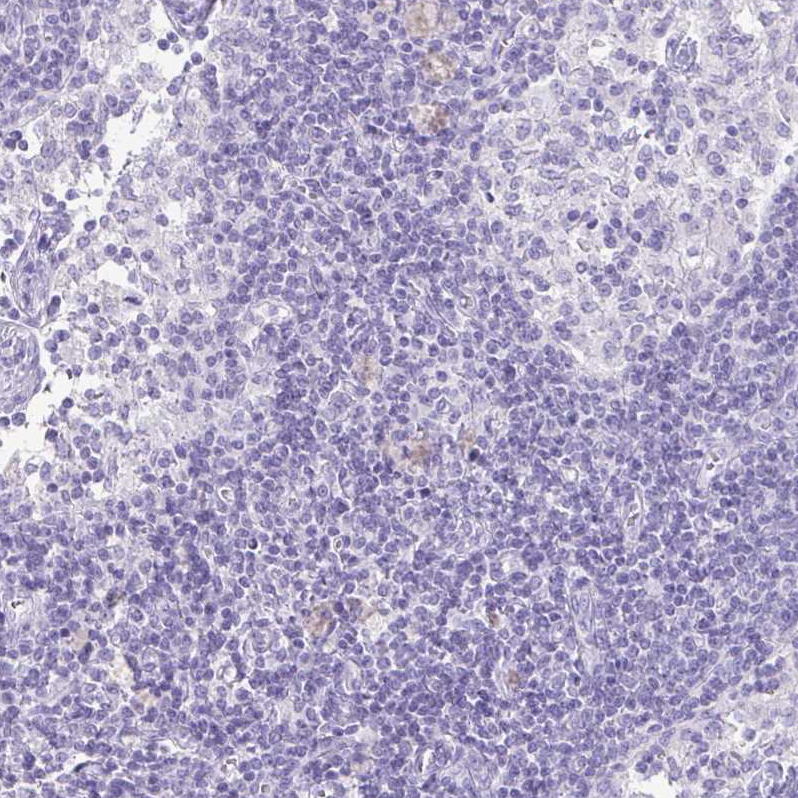 Rabbit Polyclonal Anti-SLC32A1 Antibody - Buy for research - Highly ...