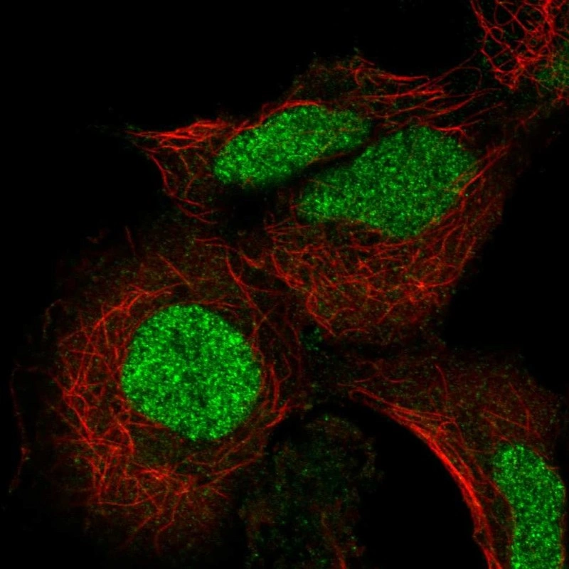Anti-ADAT3 Human Protein Atlas Antibody