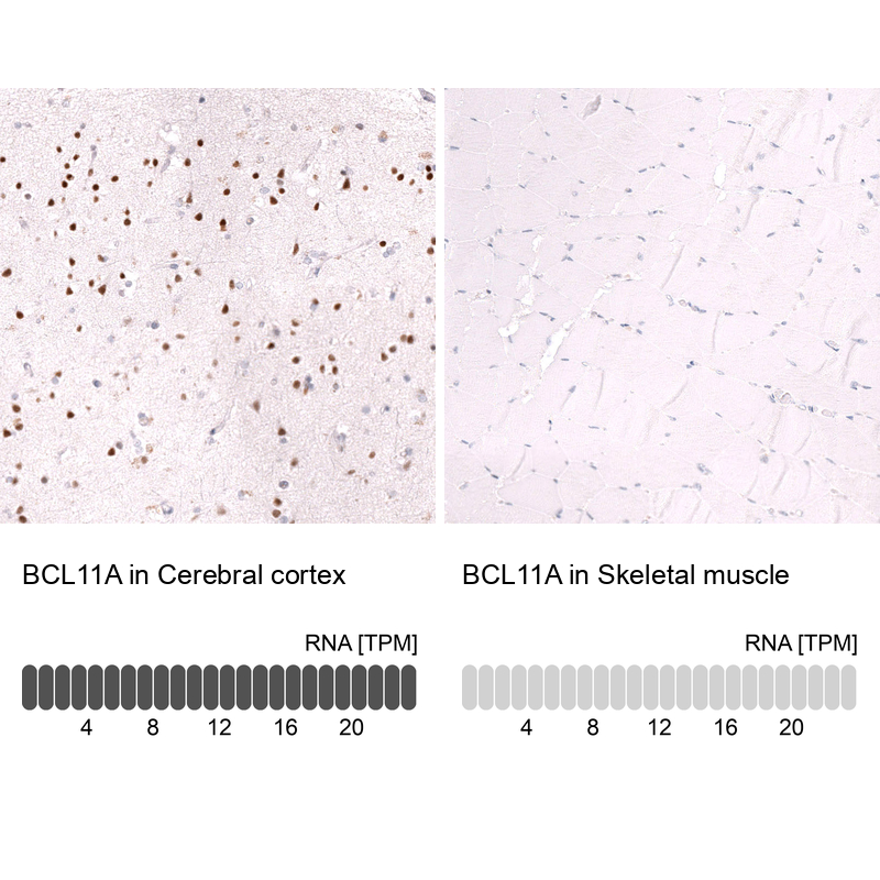 Mouse Monoclonal Anti-BCL11A Antibody - Buy for research - Highly ...