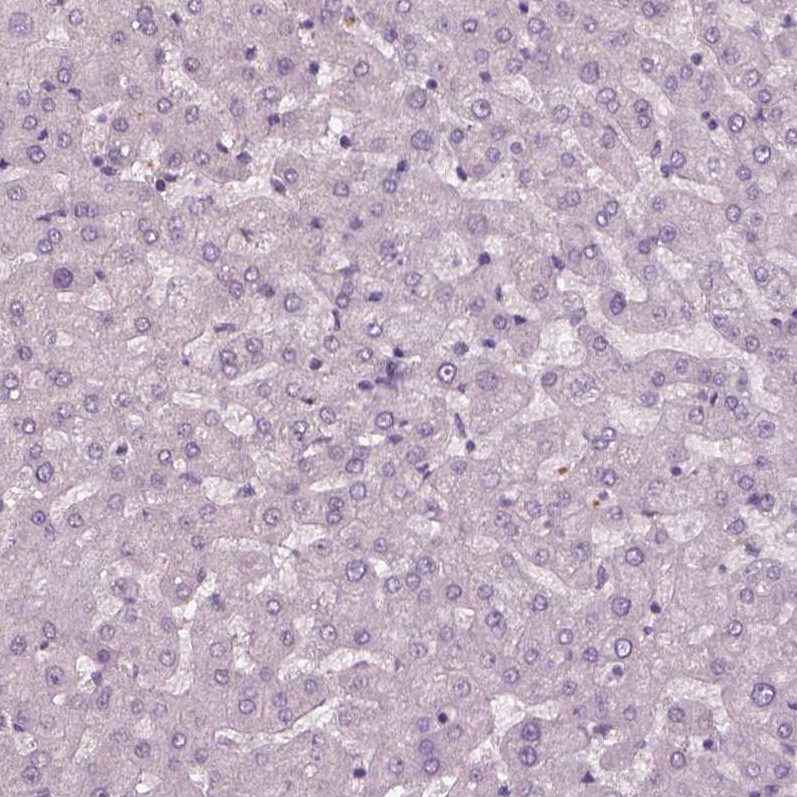 Rabbit Polyclonal Anti-KRT79 Antibody - Buy for research - Highly ...