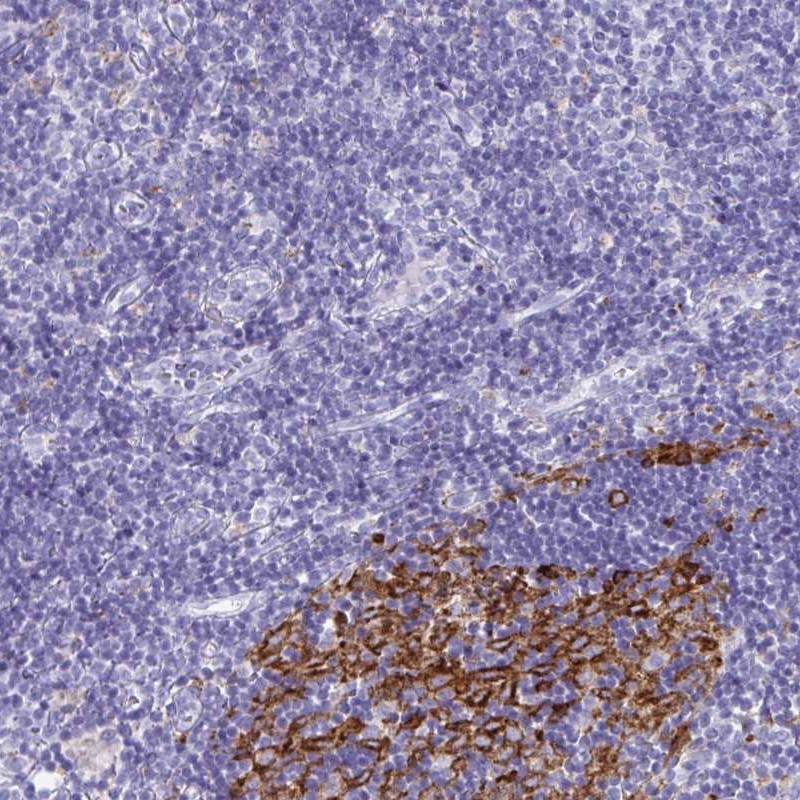 Rabbit Polyclonal Anti-CDCA4 Antibody - Buy for research - Highly specific, rigorously validated ...