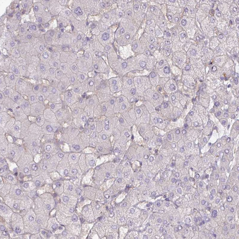 Anti-MUS81 Human Protein Atlas Antibody