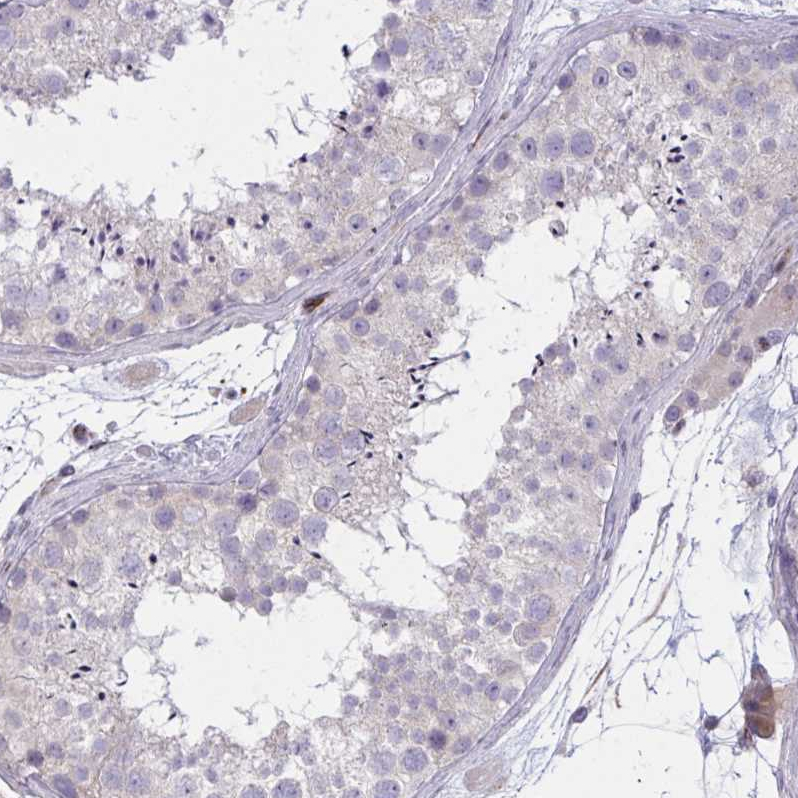Anti-SLC14A1 Human Protein Atlas Antibody